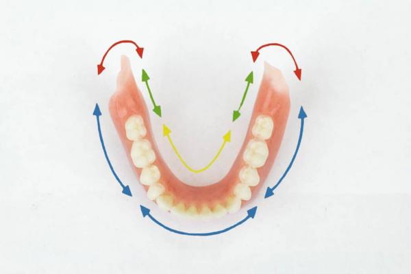 What Are Suction Dentures? | Denture Care Blog & News | Hayven Dentures ...