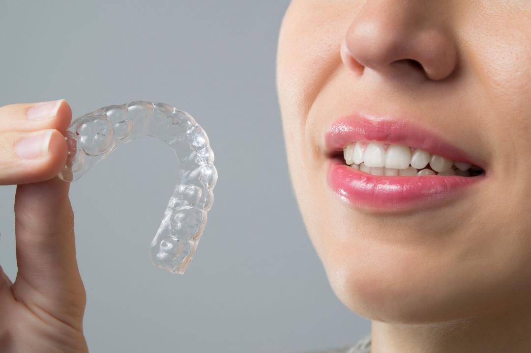 Invisalign Treatment — Kemptville Smiles Dentistry | Family & Cosmetic ...